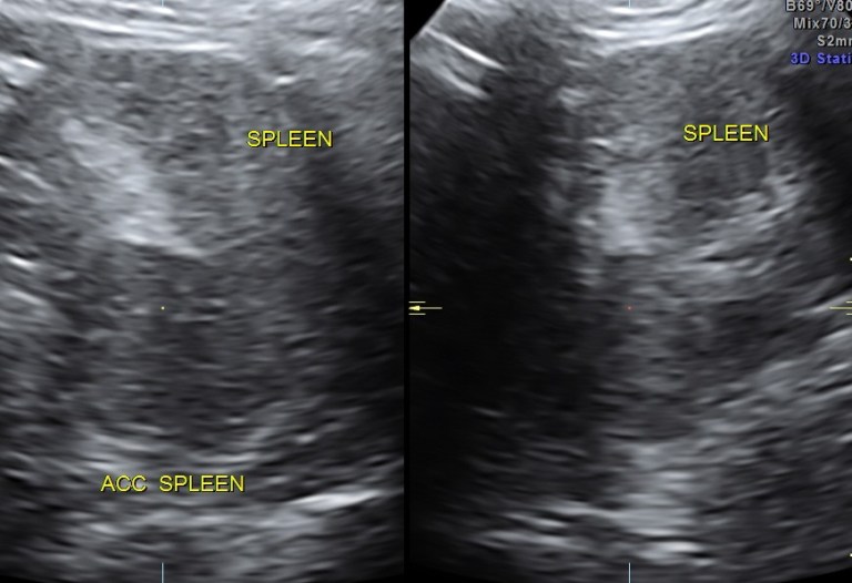 SPLENUNCULUS | Looking Through a Transducer
