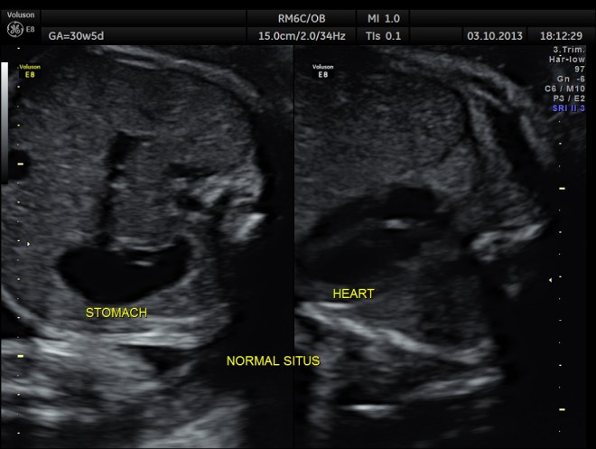TWINS – MOMO | Looking Through a Transducer