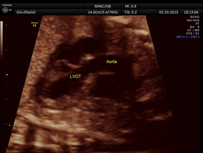 TWINS – MOMO | Looking Through a Transducer