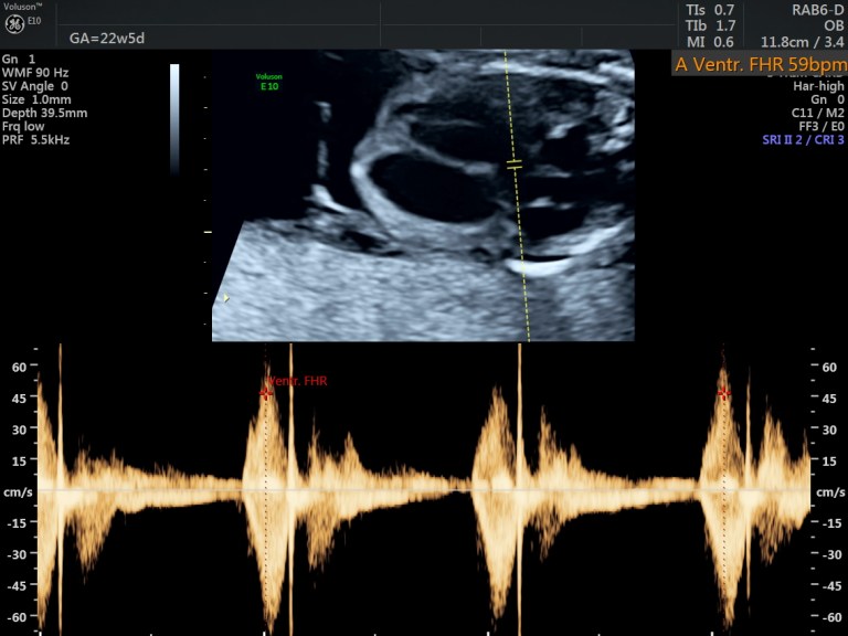CONJOINED TWINS | Looking Through a Transducer